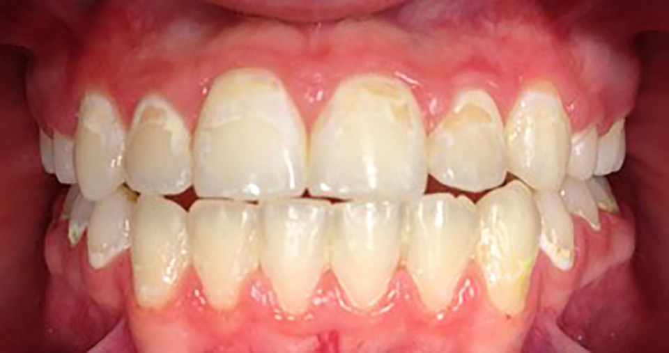 Leemans Orthodontie te Mol